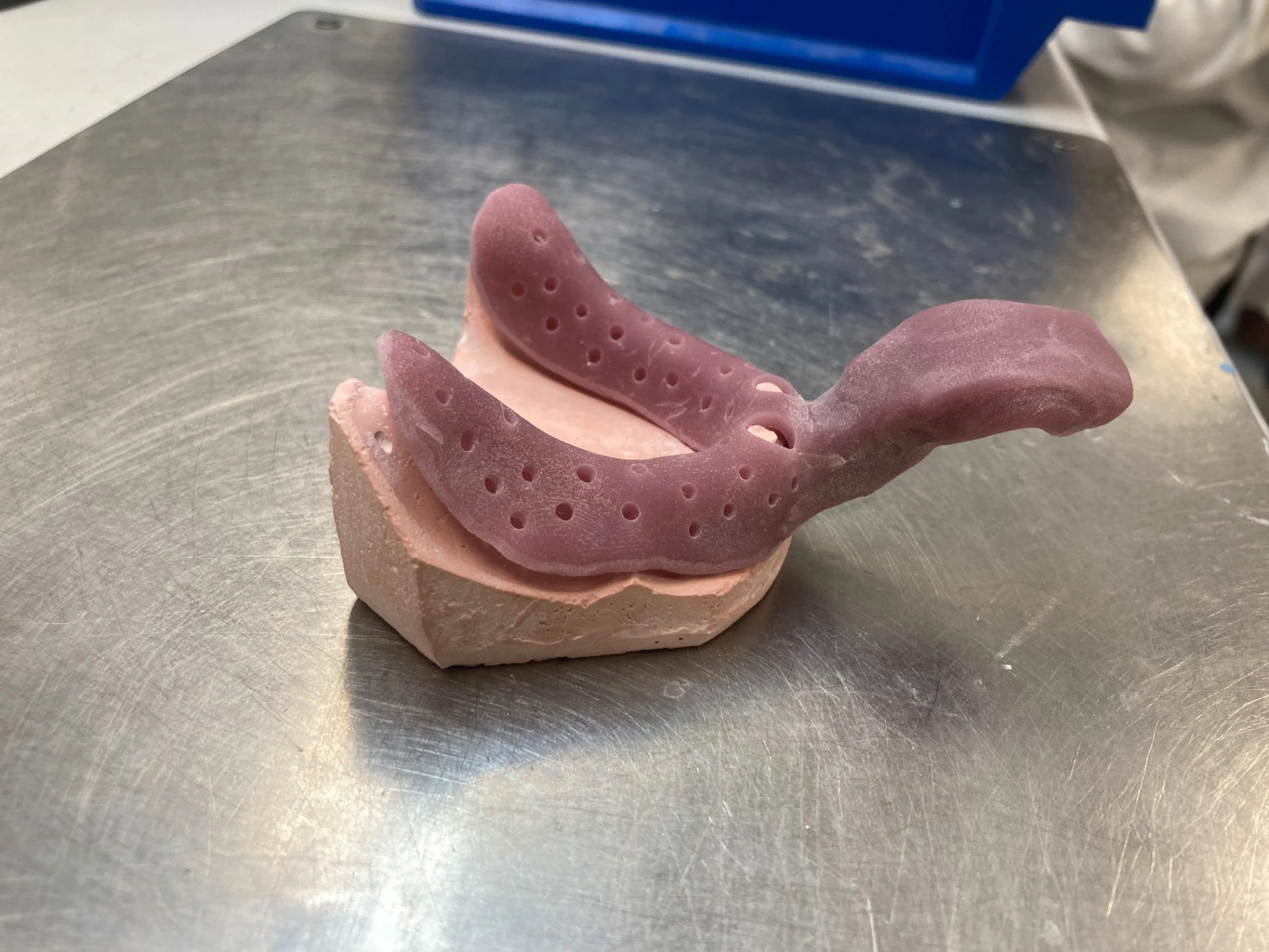 ELABORACIÓN DE CUBETA ABIERTA :: Miriam García prótesis dental
